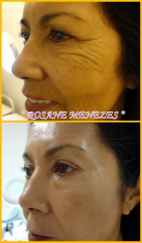 Rosane Menezes, Saúde e beleza.