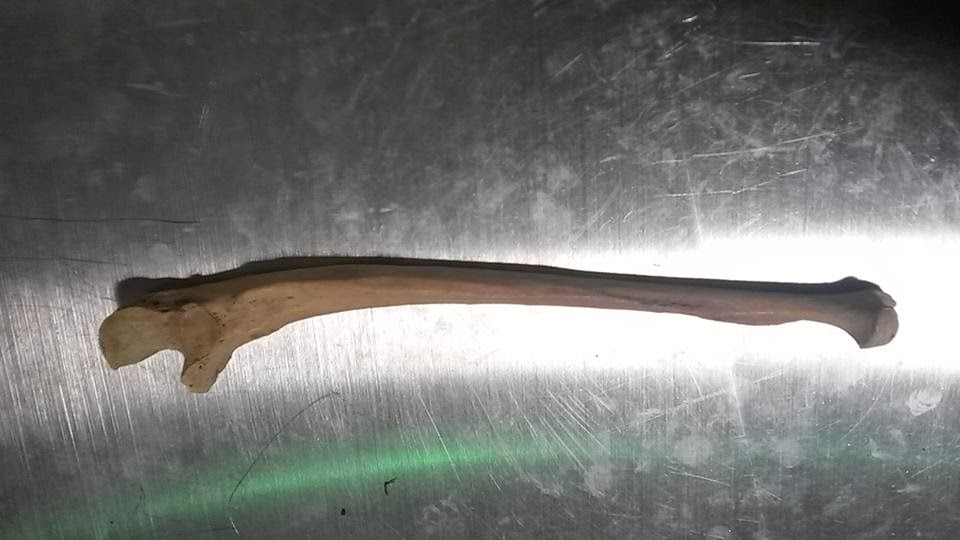 Morfofisiologia : Miembro Superior