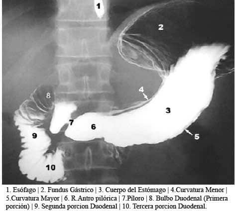 Radiografía Seriada Esofago-Gastro-Duodenal