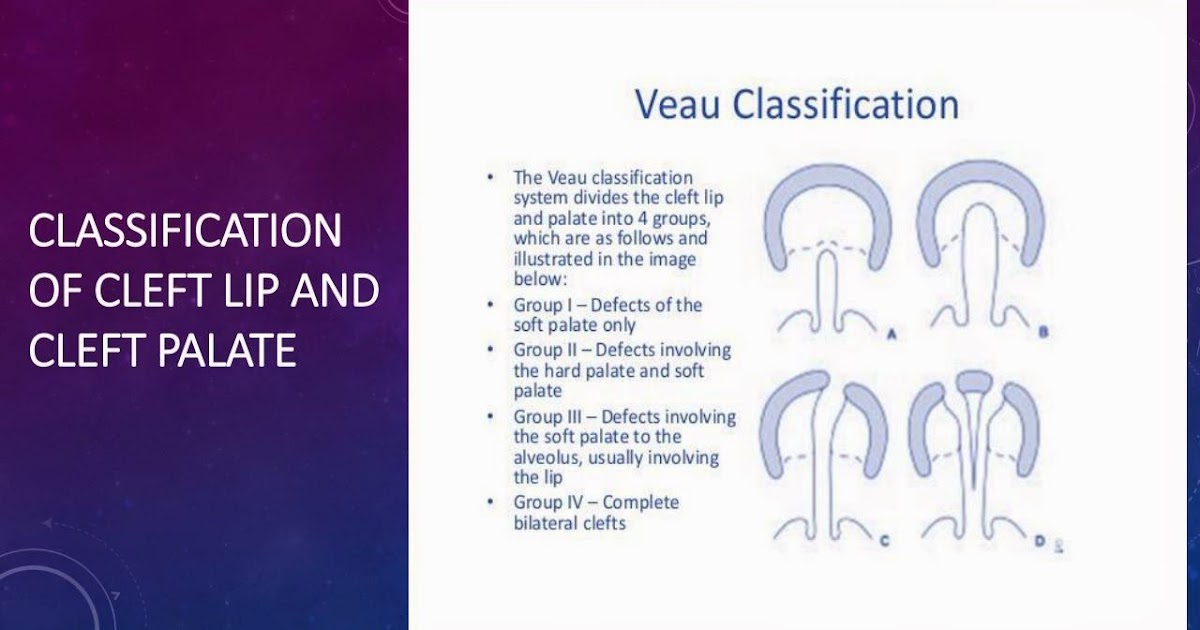RR's Paediatric Nursing: Veau classificationv- cleft lip & Palate