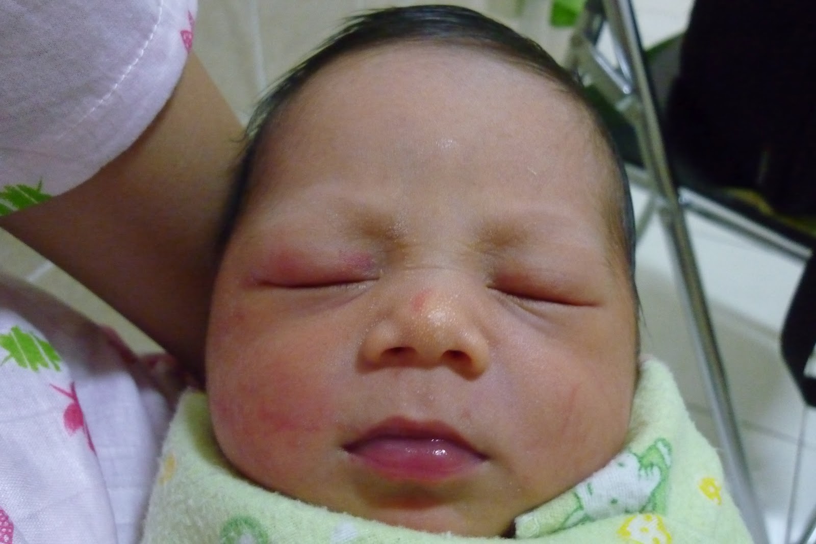 Download Koleksi 61 Memerahkan Bibir Bayi Baru Lahir Terbaru | Gubuk Derita