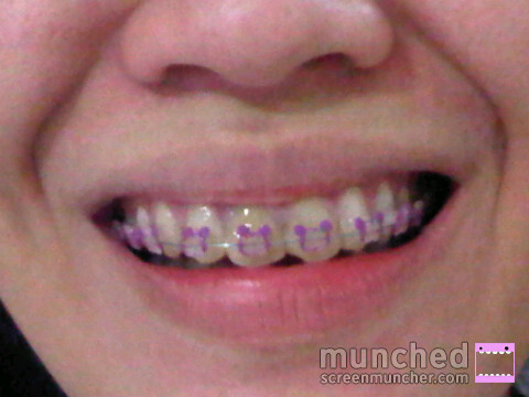 Populer 22+ Behel Fashion