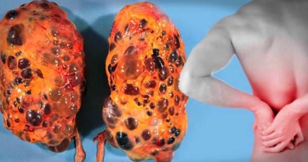 Vida Natural: Estos son los 8 hábitos que hacemos a diario que dañan ...