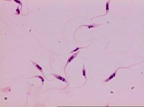 Trypanosoma cruzi - Análises Clínicas.com