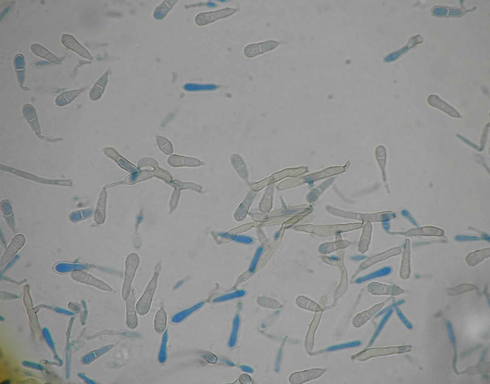 ATLAS MICOLOGIA: OCHROCONIS GALLOPAVA / VERRUCONIS GALLOPAVA