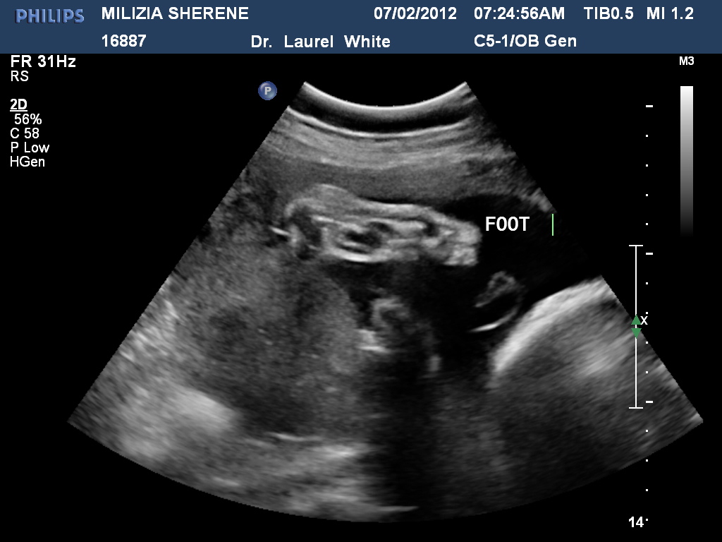 Days of our lives...: 32 weeks Ultrasound
