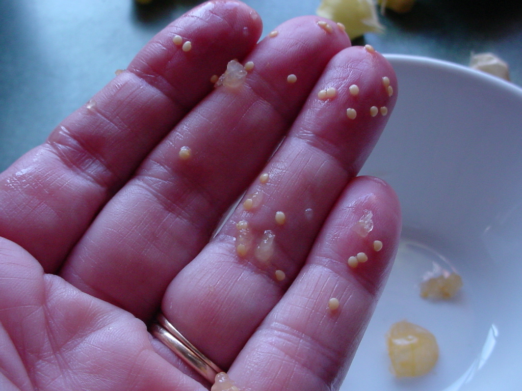 Garden of Discovery: Kid Friendly Ground Cherries