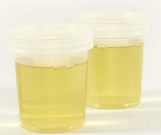 What's The Use & Health Benefits Of Cow Urine? - All Health Clue