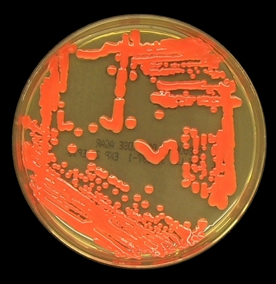 Fun With Microbiology (What's Buggin' You?): For Me, The Fun is Over....