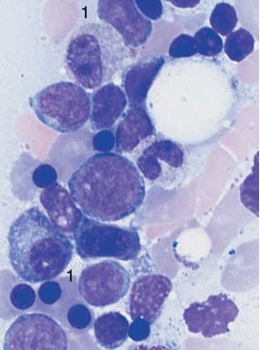 [Haematology] Abnormalities of the White Cell Series | Free Medical Atlas