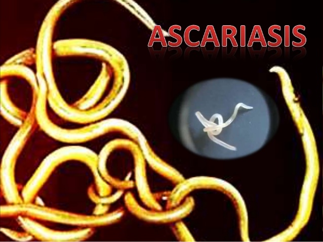 Enfermedades Causadas Por Microorganismos: Ascarasis (parasito)