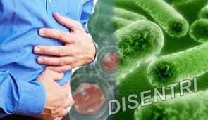 Cara Mengobati Disentri, 100% Terbukti Paling Ampuh Sembuhkan Disentri ...