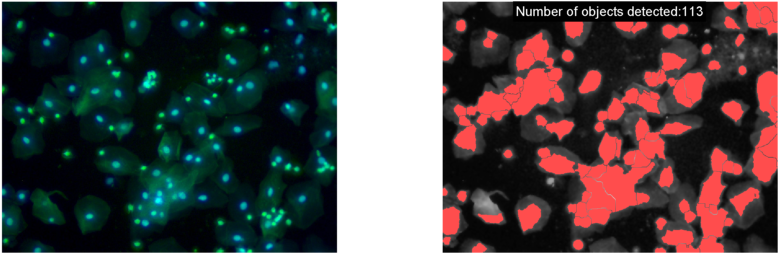 Basic Cell Counting And Segmentation In Matlab