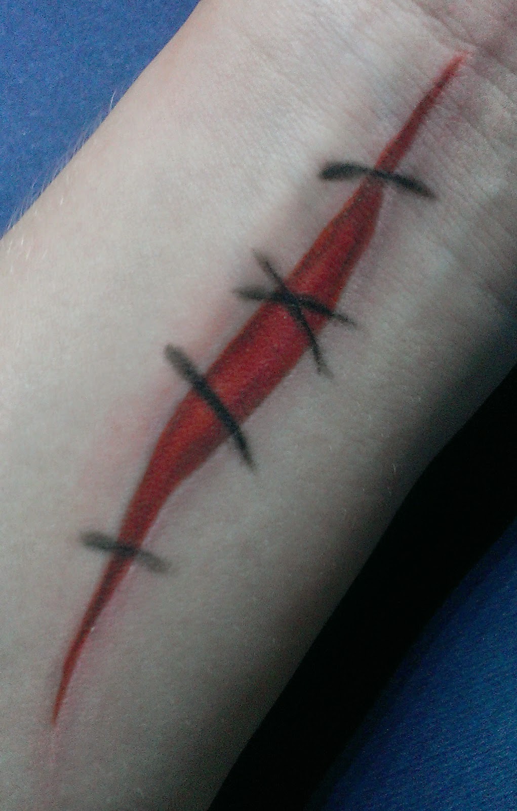 CreepyVel - the blog of creepy beauty: Open wound with stitches ...