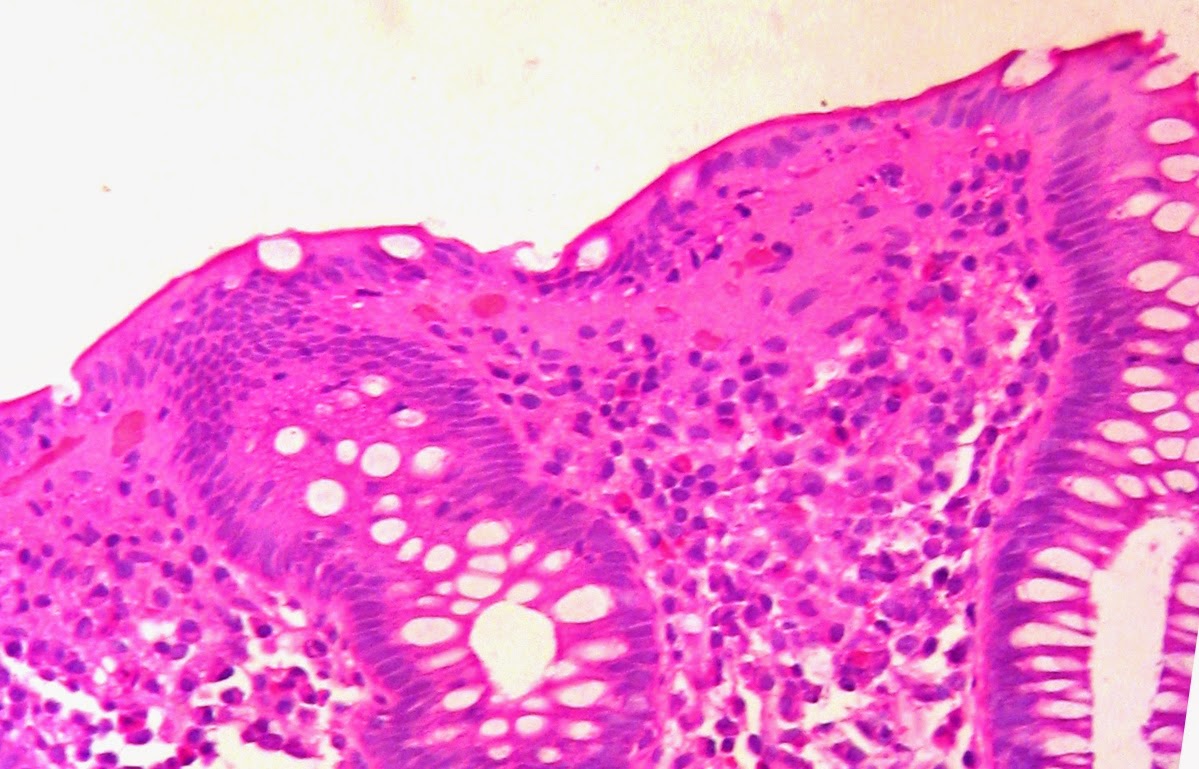 GASTROINTESTINAL AND LIVER HISTOLOGY PATHOLOGY ATLAS: COLON ...