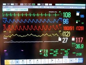All about medicine: ICU Monitor