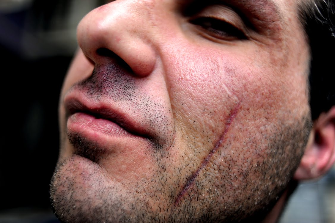 FREDDIE F.: BRUISES AND CUTS. LEKTIKOS EPEXERGASTIS