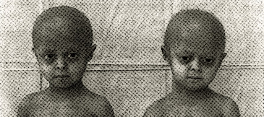 progeria family circle: erfelijkheid