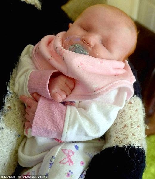 Welcome to Geophilworld's blog: Meet The Baby Born With No Eyes In Uk ...