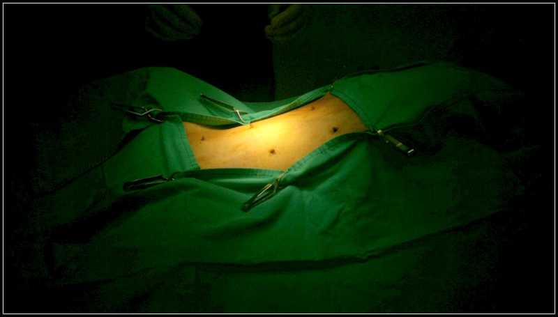 CIRUGÍAVET.ESTUDIANTE: MASTECTOMÍA SIMPLE