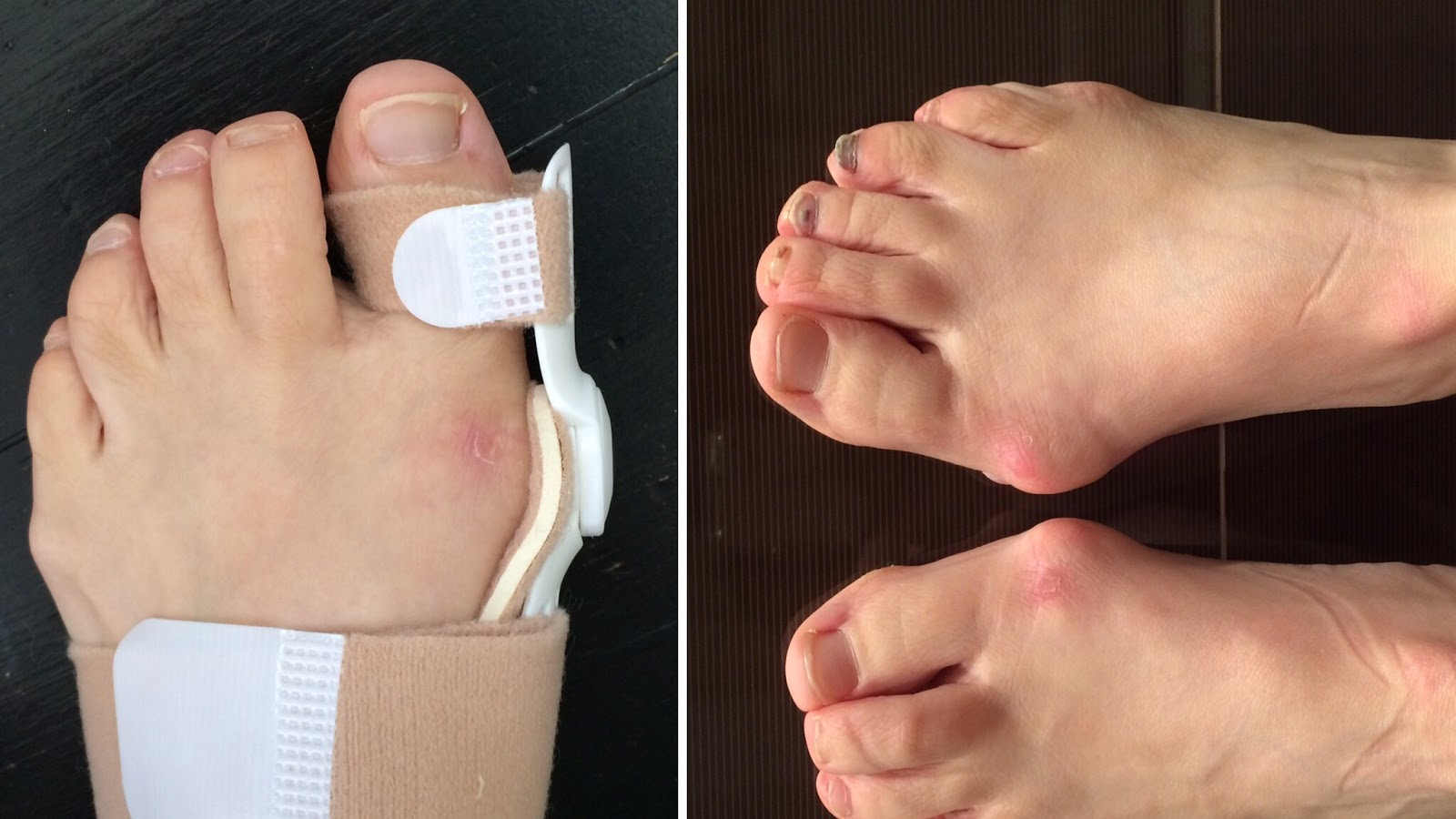 Paljastavia kuvia ja haaste: Näytä mulle sun varpaat! - pik(k)uliten