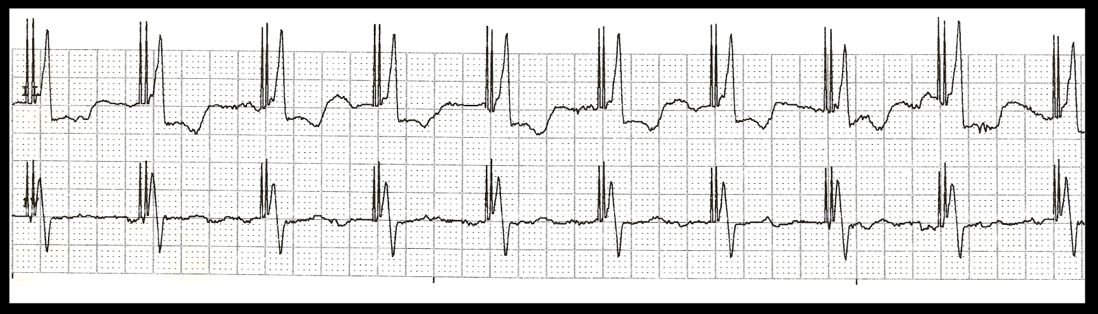 Practice EKG Strips 345