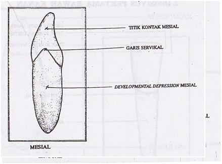 Anatomi Gigi Incisivus Pertama Rahang Bawah | Dental Hygiene