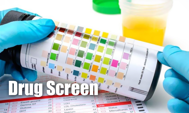 Background Searches and Checks: Why Do Employeers Really Drug Screen