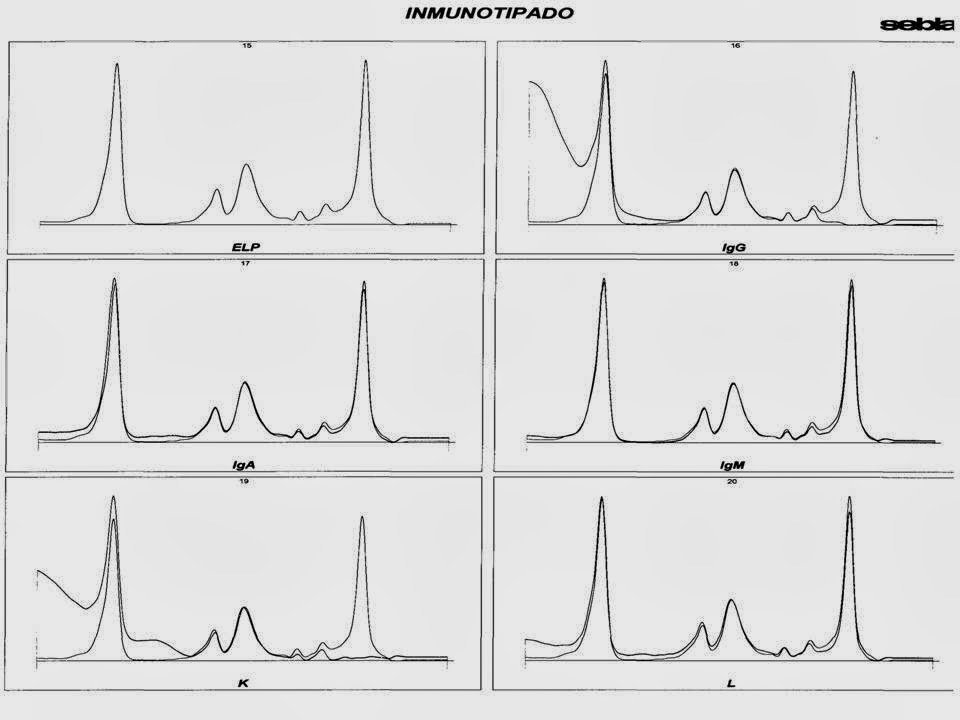 caulelab: Utilidad Clínica del Proteinograma