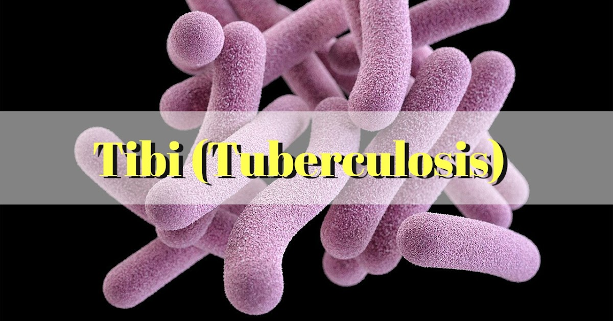 Mala Masya: Kenali Tanda-Tanda Penyakit Tibi Atau Batuk Kering Dan Cara ...