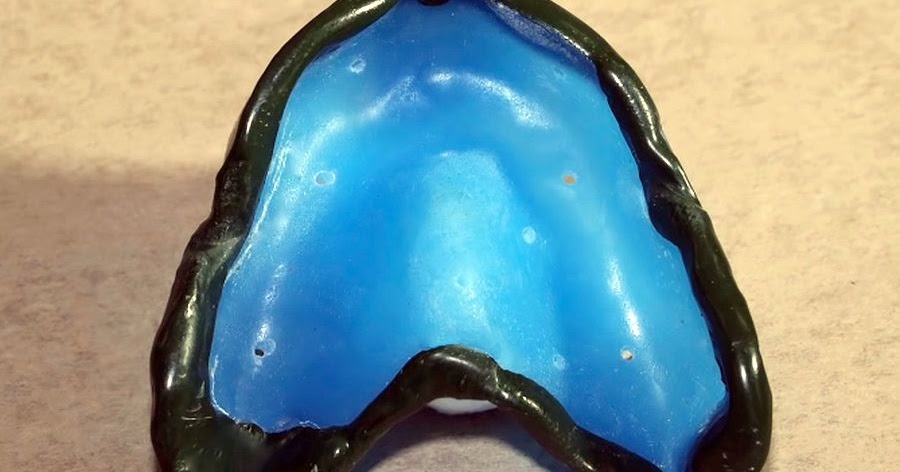 PROSTHODONTICS: Border Molding for Complete Dentures - Odonto-Tv