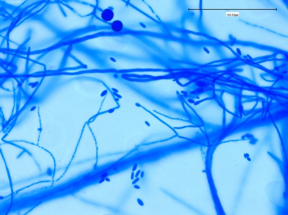 Fun With Microbiology (What's Buggin' You?): Sepedonium species