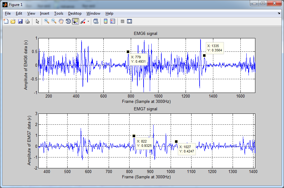 Biomedical Signal and Image Processing projects using Matlab and ...
