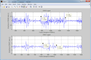 Biomedical Signal and Image Processing projects using Matlab and ...