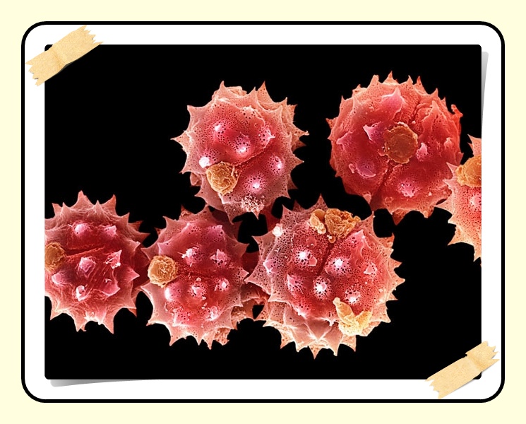 Witty Nity: Pollen Under a Microscope