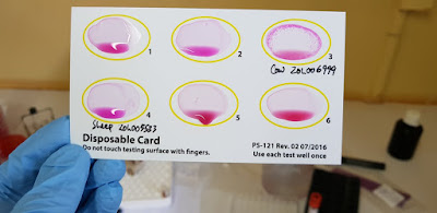 Rose Bengal Test - Microbiology Laboratory Turkey