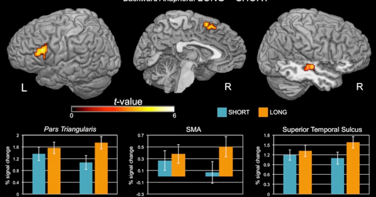 Talking Brains: Broca’s area doesn’t care what you do (syntactically ...