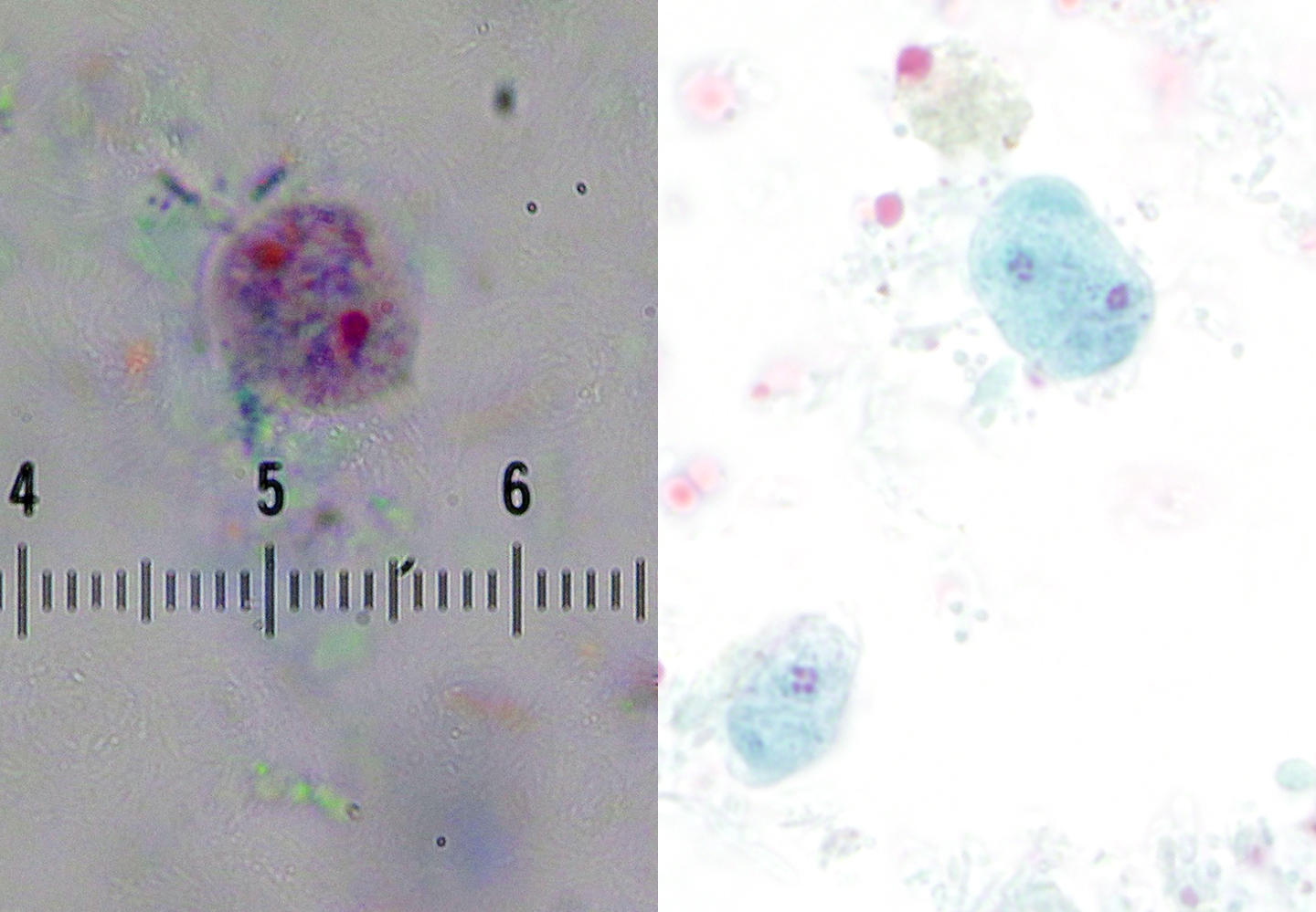 Creepy Dreadful Wonderful Parasites: Answer to Case 478