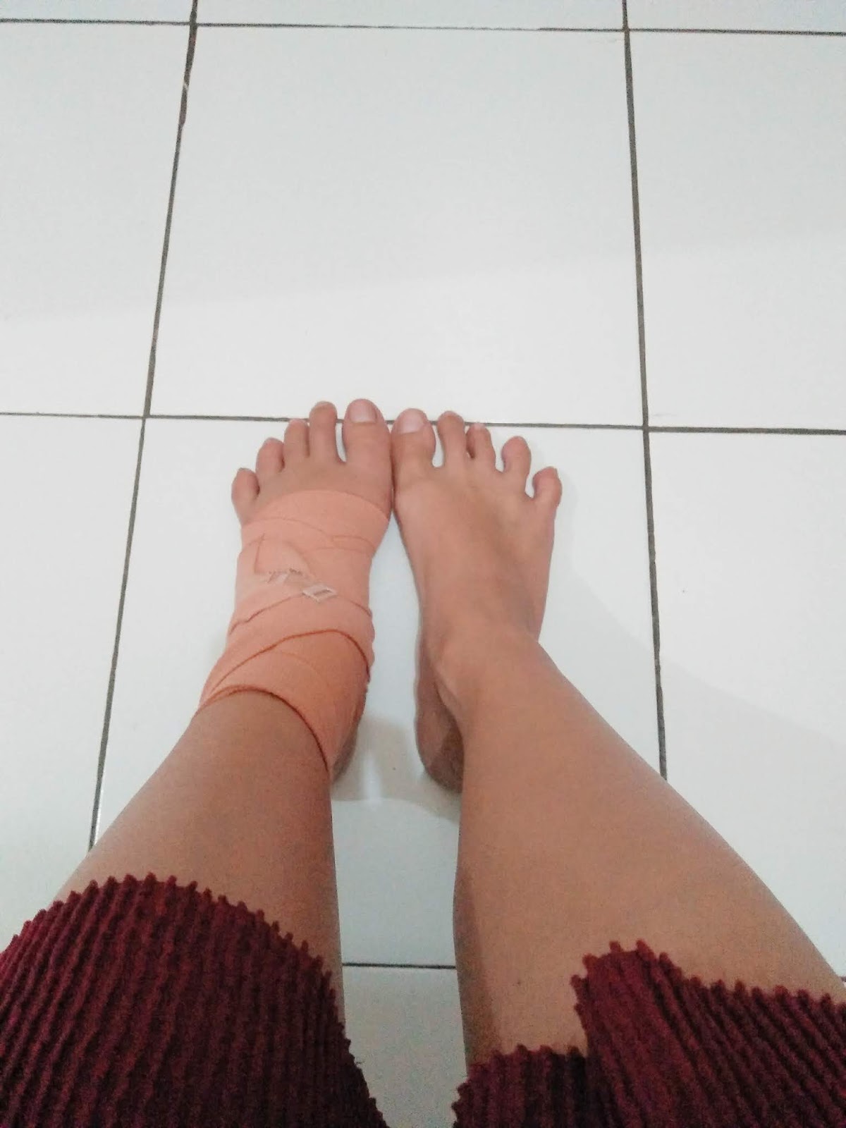 Biaya pengobatan cedera engkel (sprain ankle) MAHAL!!! - Untold Story