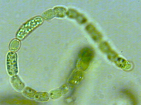 Poznávačka: Viry, bakterie, sinice, řasy