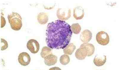 Fichero de Hematología : MORFOLOGÍA NORMAL DE CÉLULAS SANGUÍNEAS DE ...