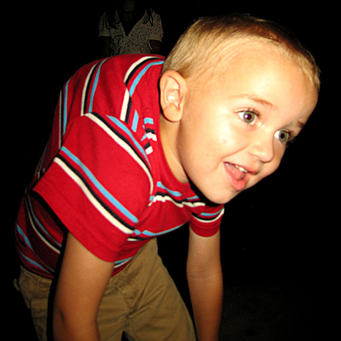 Real Hunchback People