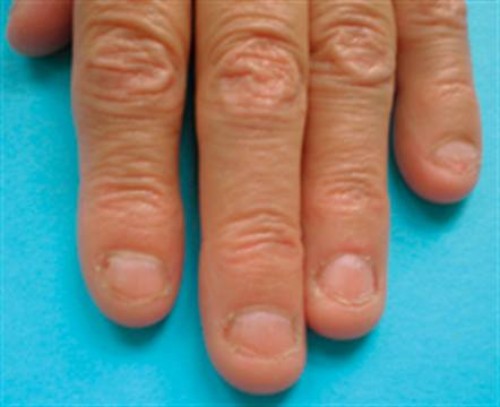 Mudamos de endereço !!: Unhas roidas