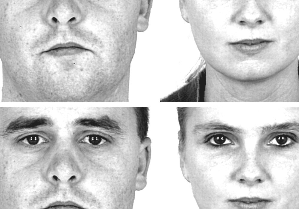 Facial Symmetry - Human Symmetry