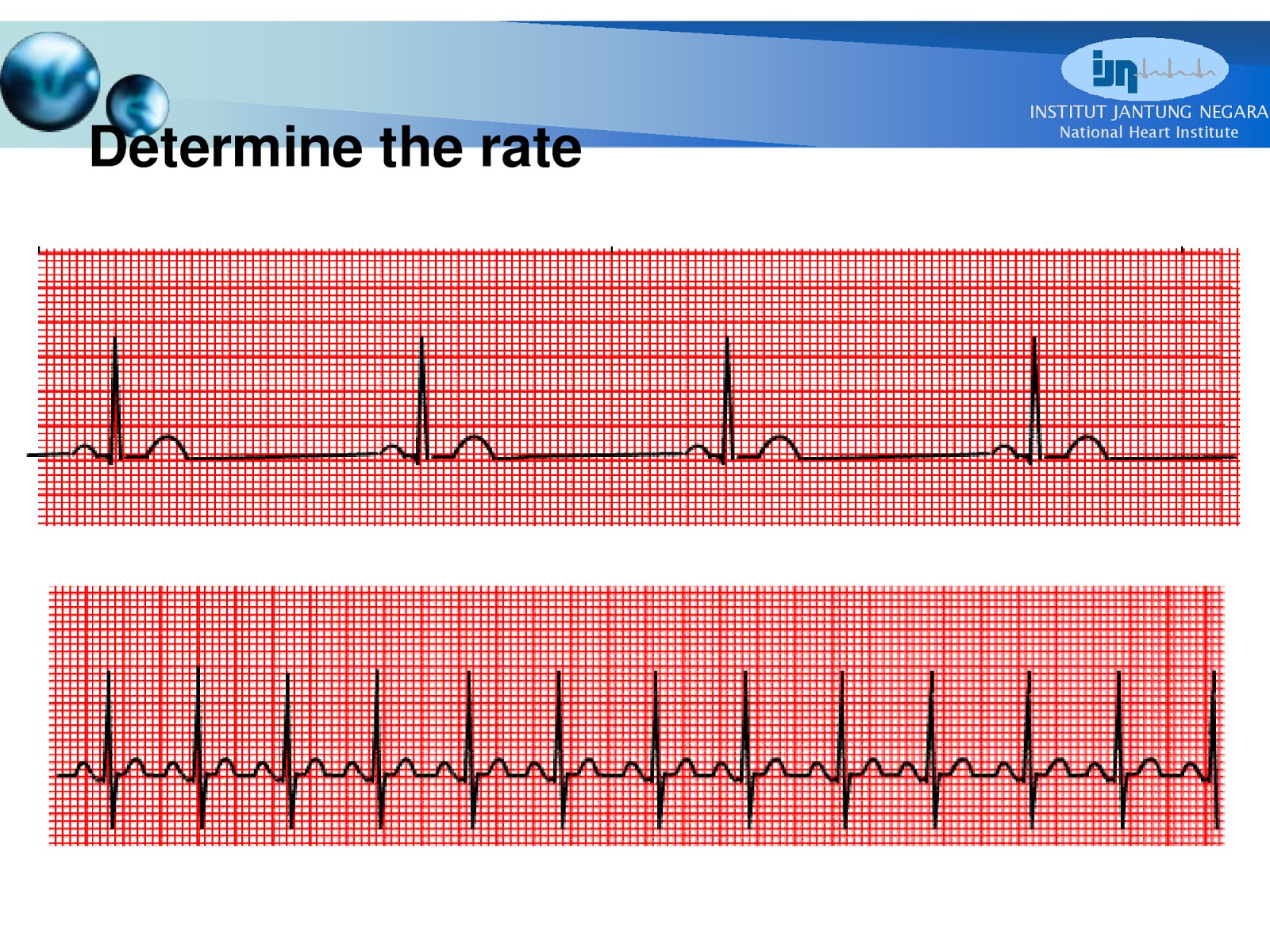 CVT Mohd Farid: Basic ECG Part II-Rate Rhythm Axis