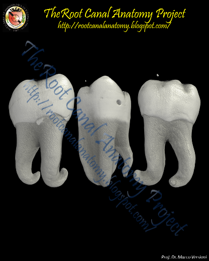 The Root Canal Anatomy Project: Root Curvature
