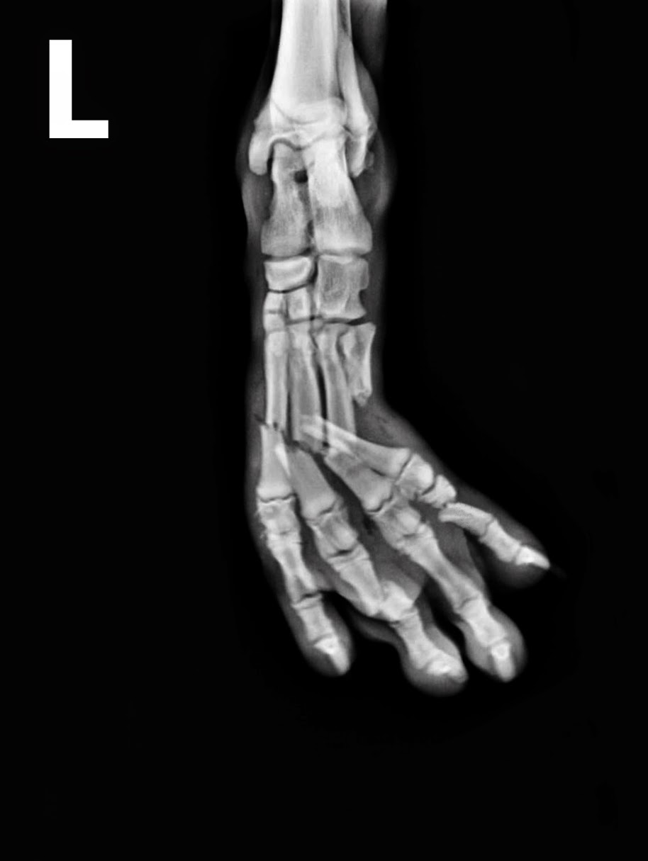 ARTROVET: Fractura de metatarsos