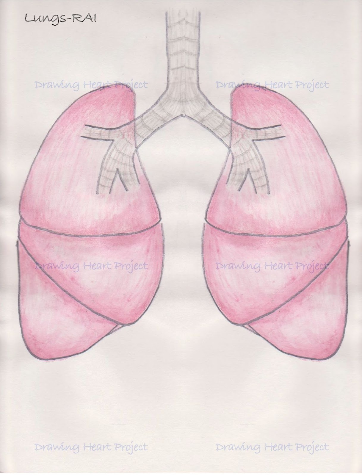 Drawing Heart: Heterotaxy RAI vs LAI