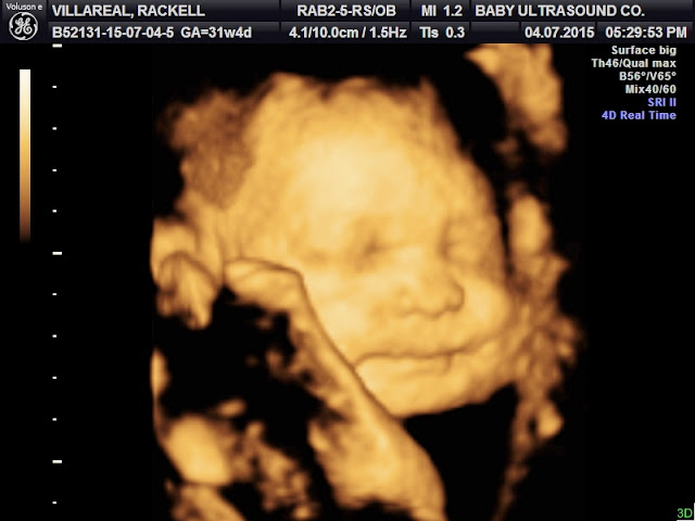 Our Journey Towards Parenthood: Baby Bunso First Baby Photos (3D/4D ...