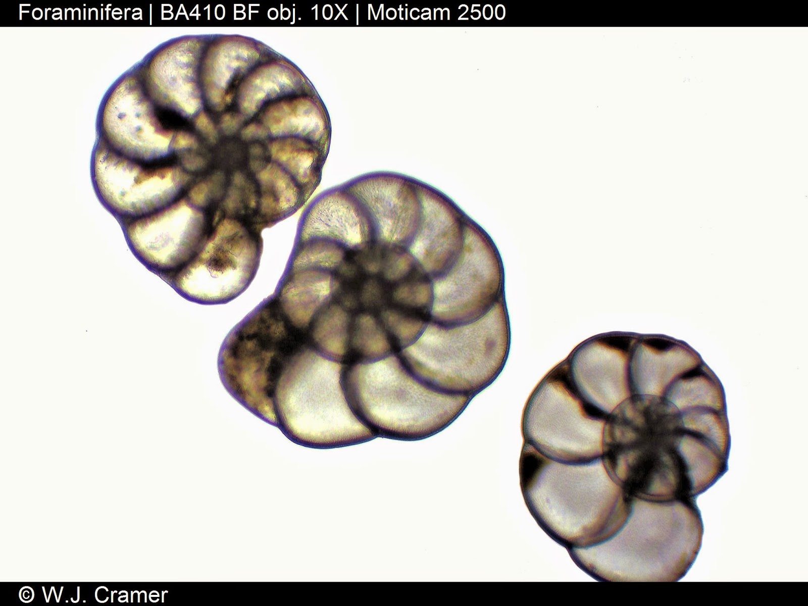 Foraminifera Under Microscope